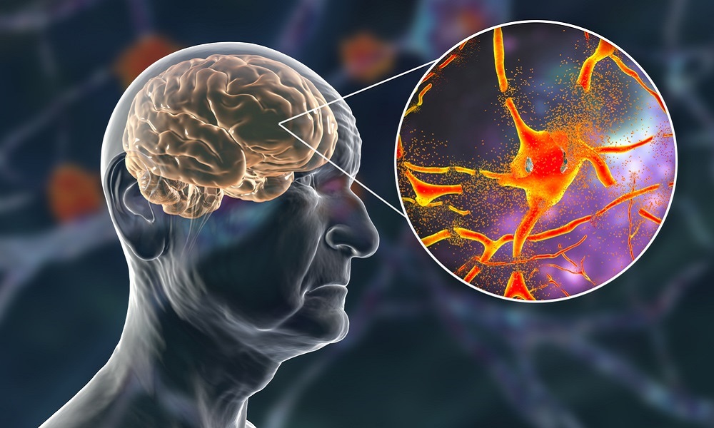 Focus Areas / Neuroscience - 2BScientific
